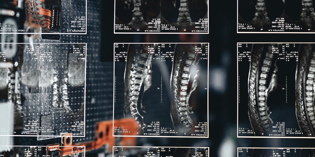 Automatizált gerinc MR leletező és vizualizált leletértelmező rendszert ...